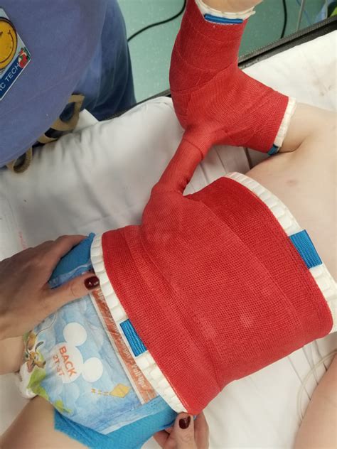 WATERPROOF CAST CONTACT AquaCast