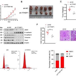 Depletion Of YTHDF1 Inhibits The Growth Of Breast Cancer Cells In Vivo