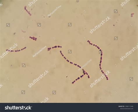 Chracteristic Gram Positive Cocci Chains Streptococcus Stock Photo