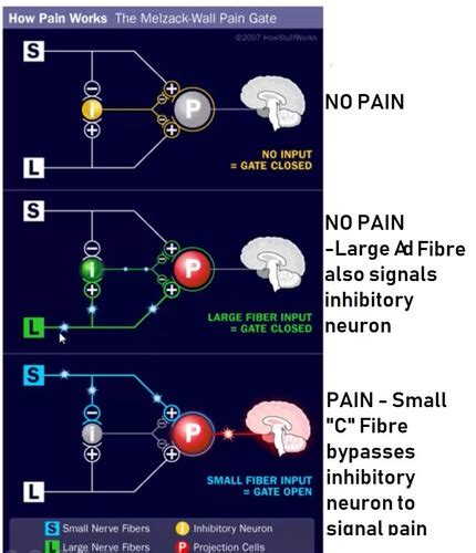 Module Pain Flashcards Quizlet
