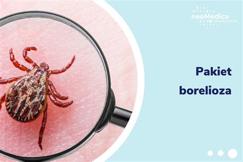 Badanie krwi na borelizę neoMedica Poznań