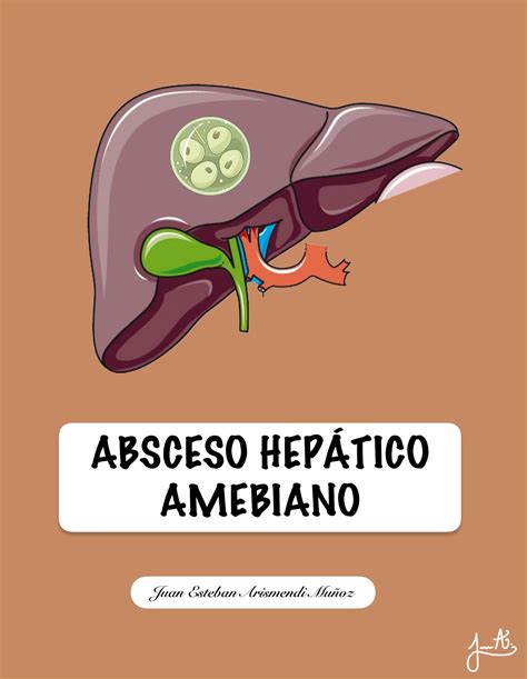 SOLUTION Absceso hepático amebiano Studypool