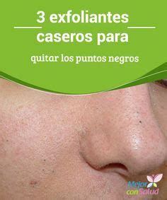 Acerca De Los Exfoliantes Caseros Para Quitar Los Puntos Negros