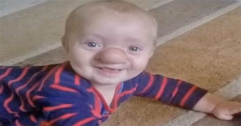 À cause de son gros nez ce petit garçon est moqué et comparé à Pinocchio