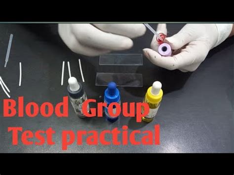 Blood Group Test Practical Procedure For Determination Of Blood Group