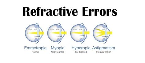 Common Eye Problems Signs And Symptoms Eye Problems List