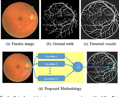 [pdf] ensemble of deep convolutional neural networks for learning to detect retinal vessels in