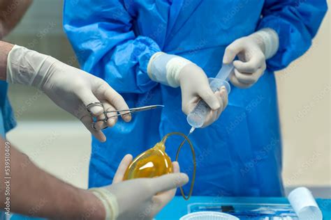 Penis Penile Implant Penis Enlargement Surgery Balloon Insertion Inflation Penile Prosthesis