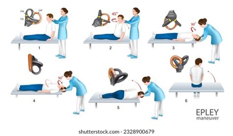 Epley Maneuver Canalith Repositioning Procedure Treatment 58 OFF