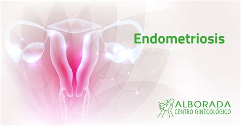 Endometriosis origen síntomas y tratamiento