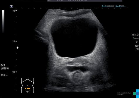 Unterbauch Sonographieatlas Erlangen