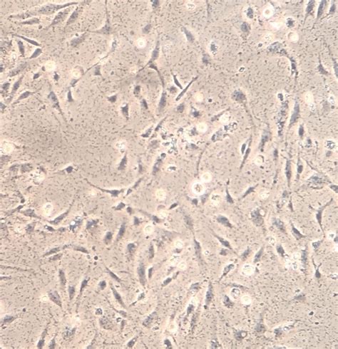 How To Get Rid Of Yeast Contamination In Cell Culture At Inez Rodriguez