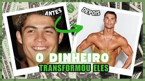 Famosos Que Eram Horr Veis E O Dinheiro Transformou Antes E Depois