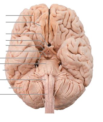 Ventral Surface Of Brain Diagram Quizlet