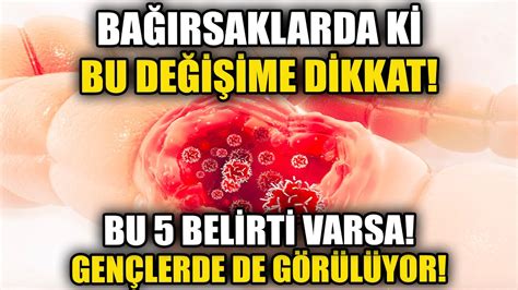 Bağırsaklardaki Bu Değişime Dikkat Kolon Kanserinin 5 Belirtisi YouTube