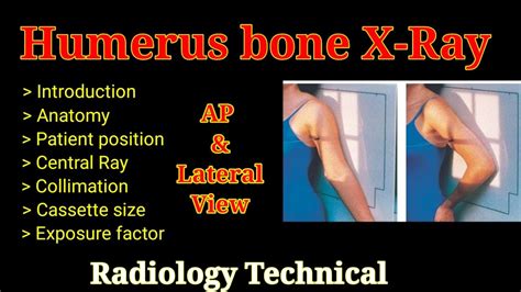 Humerus Arm Bone X Ray AP Lateral View By BL Kumawat YouTube