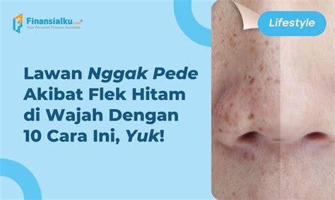 Ampuh Begini 10 Cara Menghilangkan Flek Hitam Di Wajah