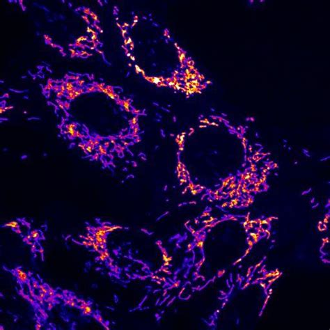 Fluorescence Microscopy Image Image Eurekalert Science News Releases