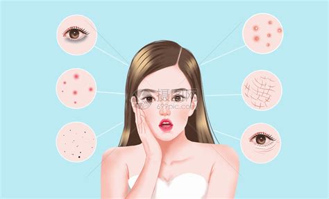 女性皮肤问题插画GIF动图图片 正版gif素材401775842 摄图网