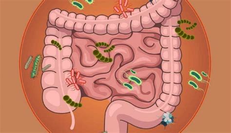 ℹ Sobrecrecimiento Bacteriano del Intestino Delgado SIBO Tu mejor guía