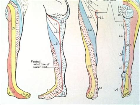 Foot Dermatome Map Dermatome Map
