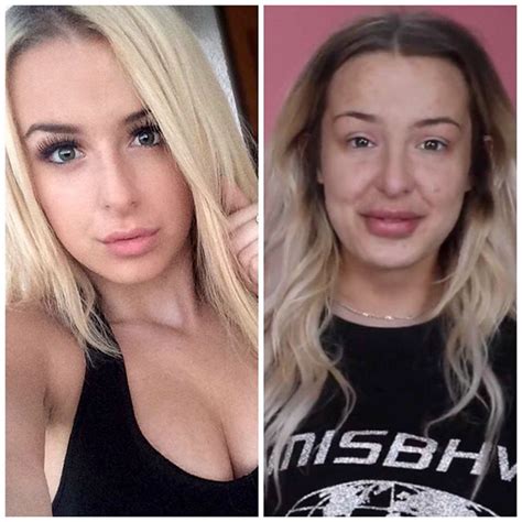 People Who Took Plastic Surgery Too Far Wtf Gallery Ebaum S World