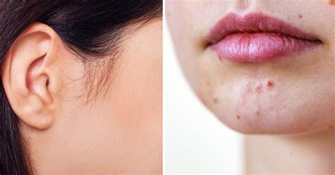 Vello Facial En Mujeres Mejores Consejos Para Eliminarlos O