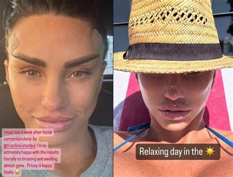 Katie Price dévoile son nouveau look après une nouvelle chirurgie
