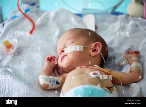Neonatal Intensive Care Hi Res Stock Photography And Images Alamy