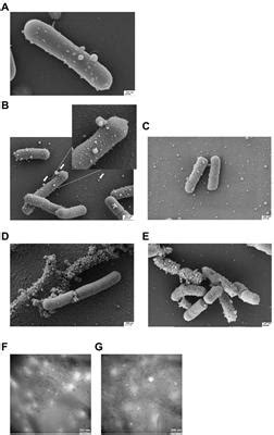 Frontiers Extracellular Membrane Vesicles From Limosilactobacillus