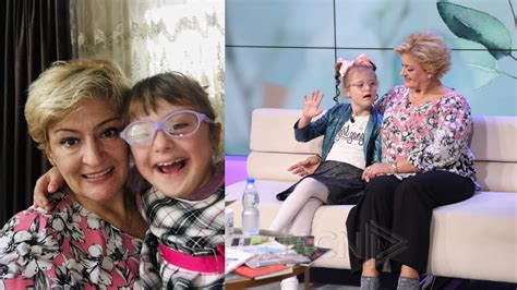 Lindi vajzë 20 vite pas djalit trauma e përballjes me sindromen down