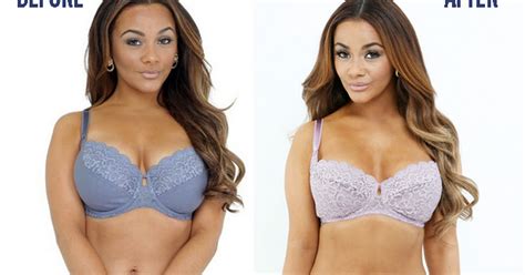 Breast Reduction Before And After Ddd