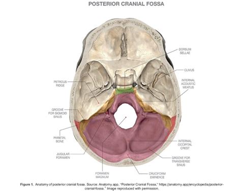 Anaesthesia For Posterior Cranial Fossa Surgery Virtual Library