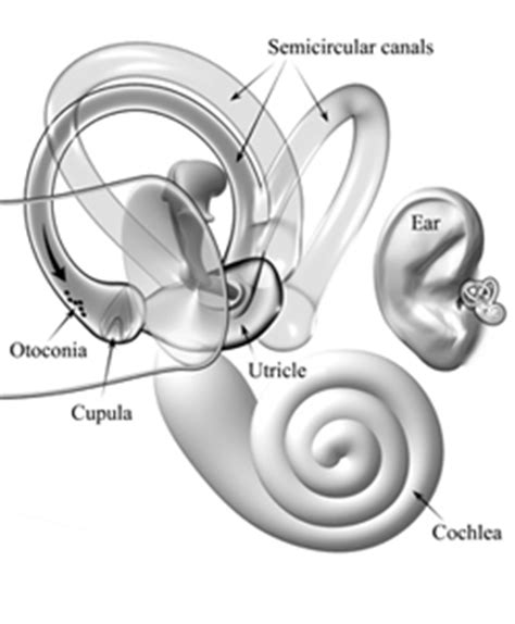 Benign Paroxysmal Positional Vertigo Bppv Treatment Symptoms Causes