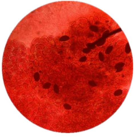 Parasitology 1 2 3 Moving Exam Flashcards Quizlet
