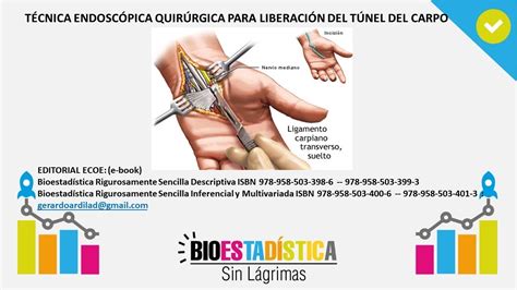 TÉCNICA ENDOSCÓPICA QUIRÚRGICA PARA LIBERACIÓN DEL TÚNEL DEL CARPO