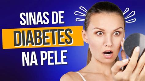 Sinais De Diabetes Na Pele