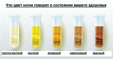 Что цвет мочи говорит о состоянии вашего здоровья