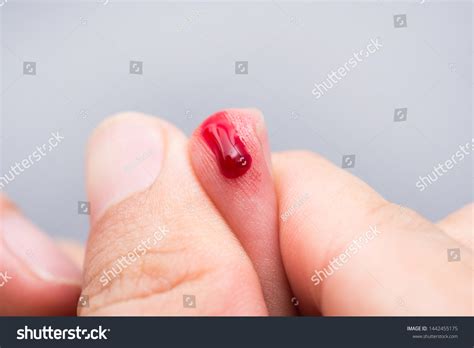 Bleeding Blood Cut Finger Wound Injured Stock Photo Edit Now 1442455175