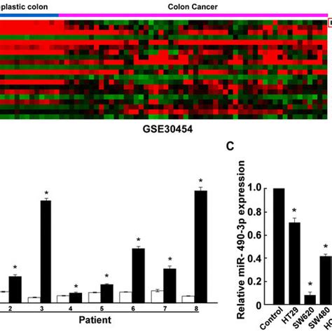 Downregulation Of MiR 490 3p In Human CRC Tissues And Cell Lines A