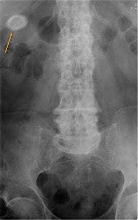 Clin Imaging Exam Flashcards Quizlet