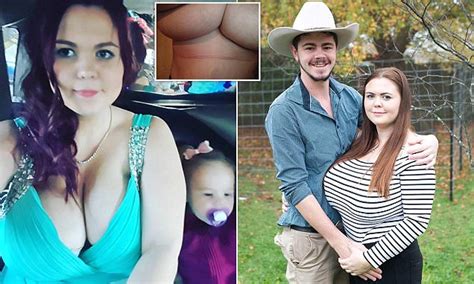 Victoria Mother Has K Cup Breasts That Keep Growing Daily Mail Online