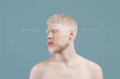 Albinos Naked Telegraph