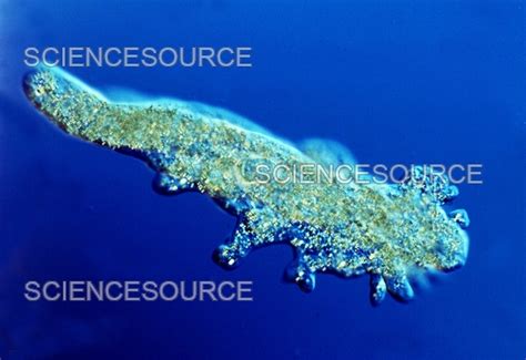 Amoeba Under Microscope 400x