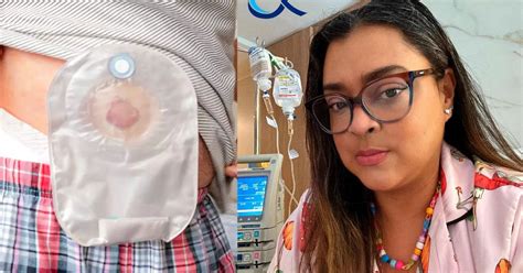 Preta Gil O que é e para que serve bolsa de colostomia que a cantora
