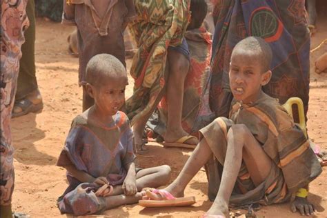 Fome causa metade das mortes entre crianças africanas Planeta