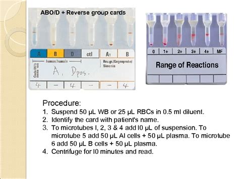 Practical Blood Bank Lab Abo Grouping