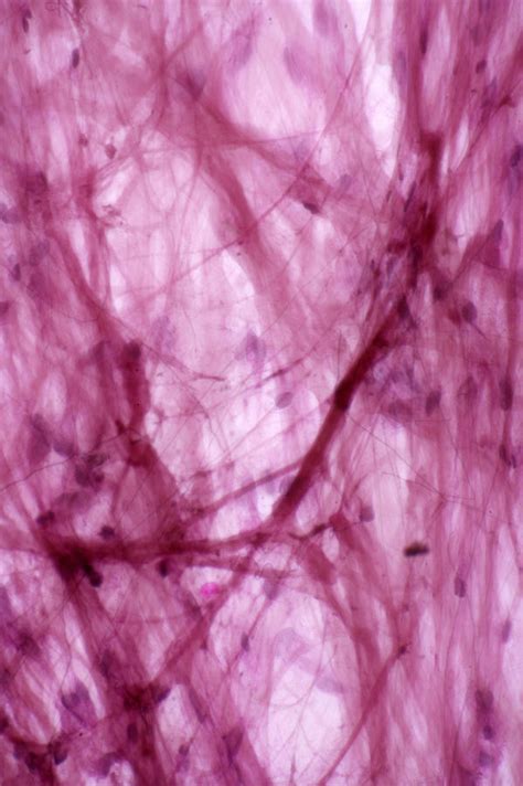 Areolar Connective Tissue Lm Photograph By Science Stock Photography