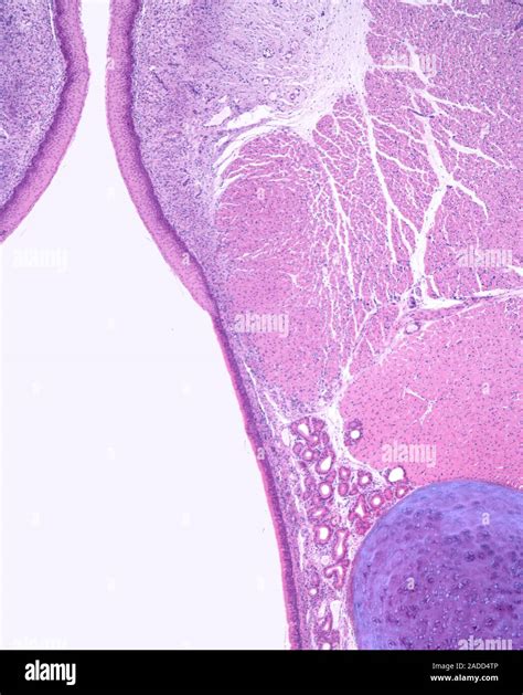 Transition Of Epithelia Between Stratified Squamous Epithelium Of The