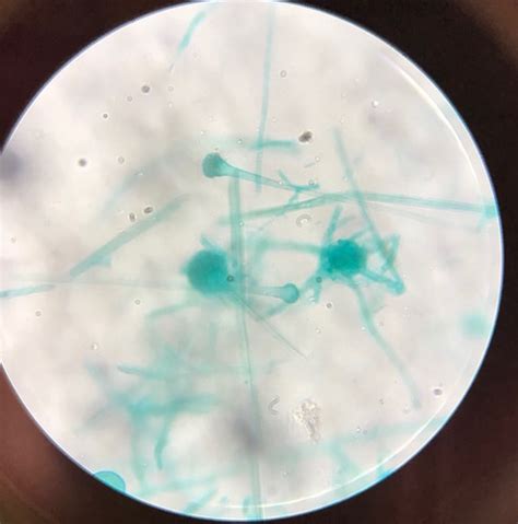 Lab Exam Kingdom Fungi Flashcards Quizlet